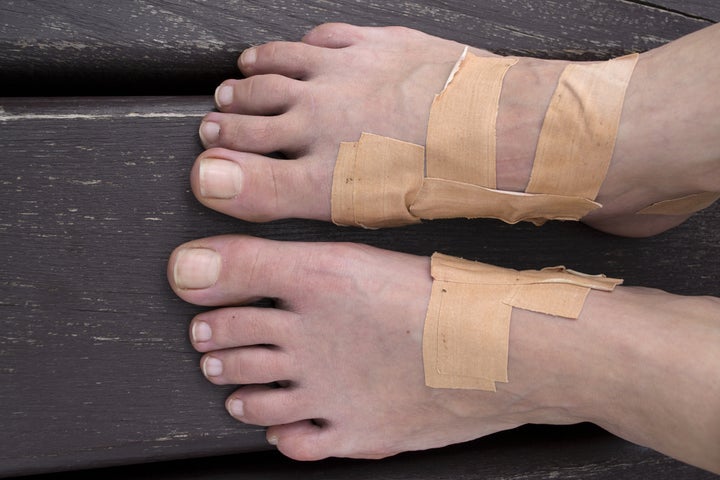 What Causes Pesky Blisters And How To Handle Them